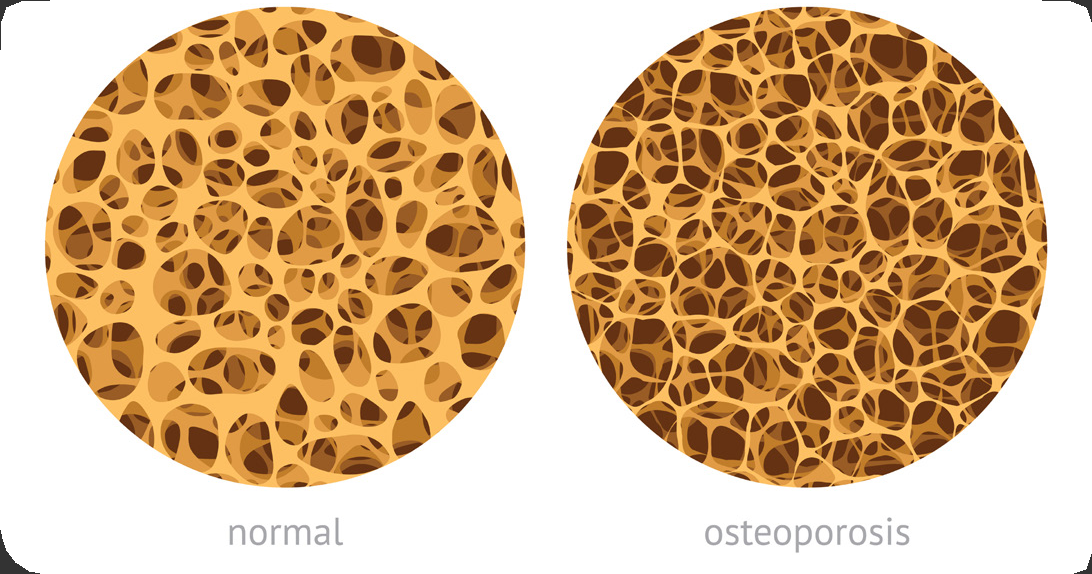 Menopause – Rockingham Women's Health Centre